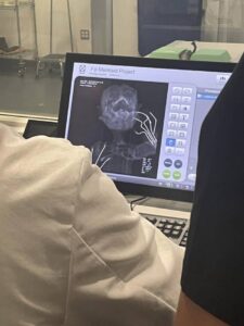 Researchers Working To Unlock The Mystery Of A 'Fiji Mermaid'