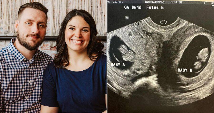 Alabama Woman With Two Uteruses Is Pregnant In Both Of Them