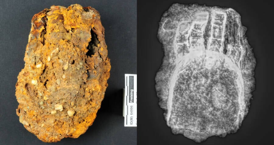 400-Year-Old Skeleton With Prosthetic Hand Found In Germany