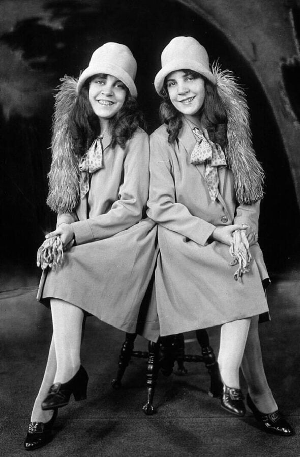 Who Was Jean-Jacques Libbera, The 'Double-Bodied Man'?