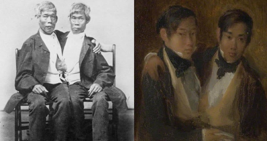 Chang And Eng Bunker, The Siamese Twins Who Became Showmen