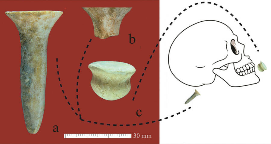 Evidence Of 11,000-Year-Old Facial Piercings Discovered In Turkey