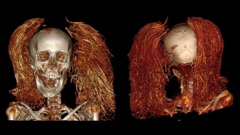 'Screaming Mummy' May Have Died In Agony, Study Suggests