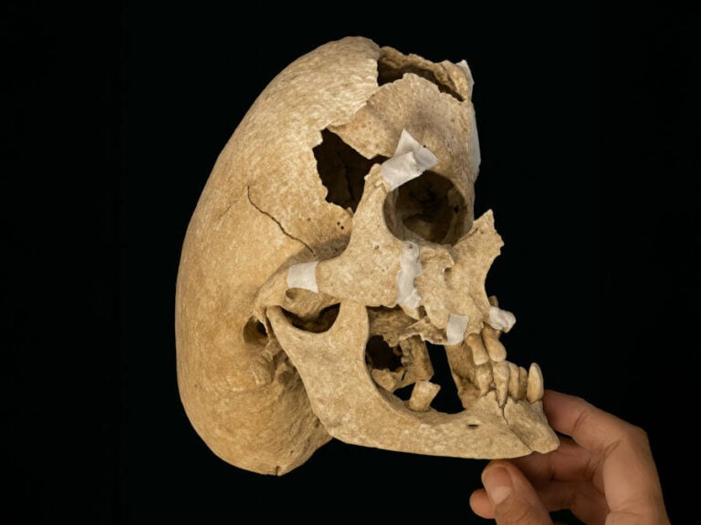 Deformed Skull Of Medieval Warrior Monk Found In Spain