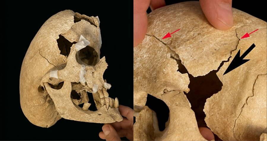 Deformed Skull Of Medieval Warrior Monk Found In Spain