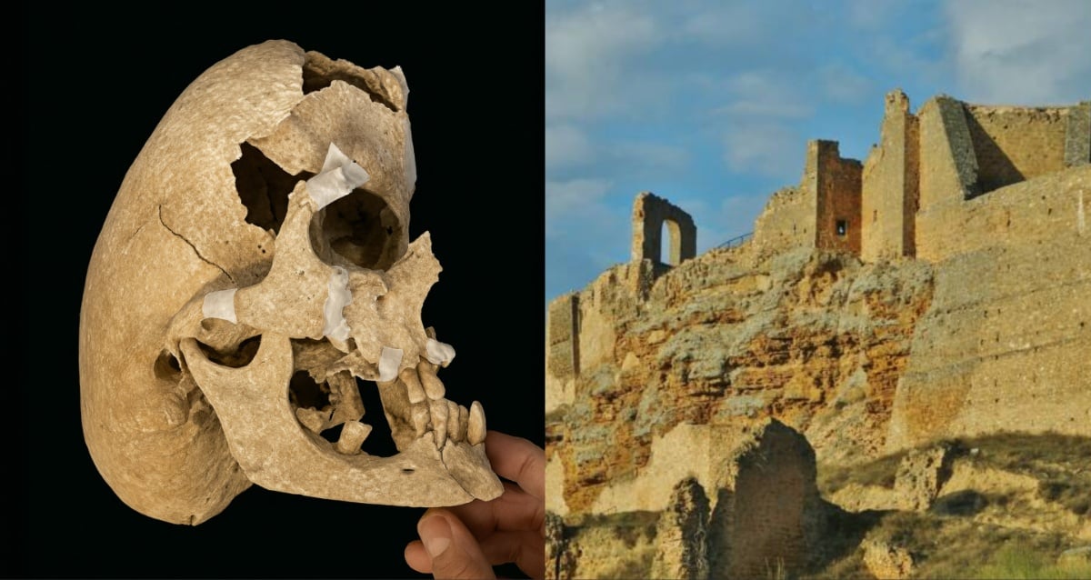Deformed Skull Of Medieval Warrior Monk Found In Spain