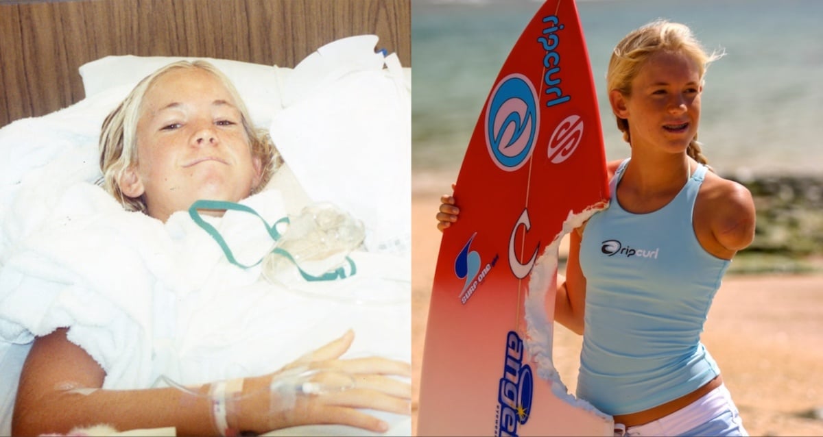 9 Of The Worst Shark Attacks In Recorded History