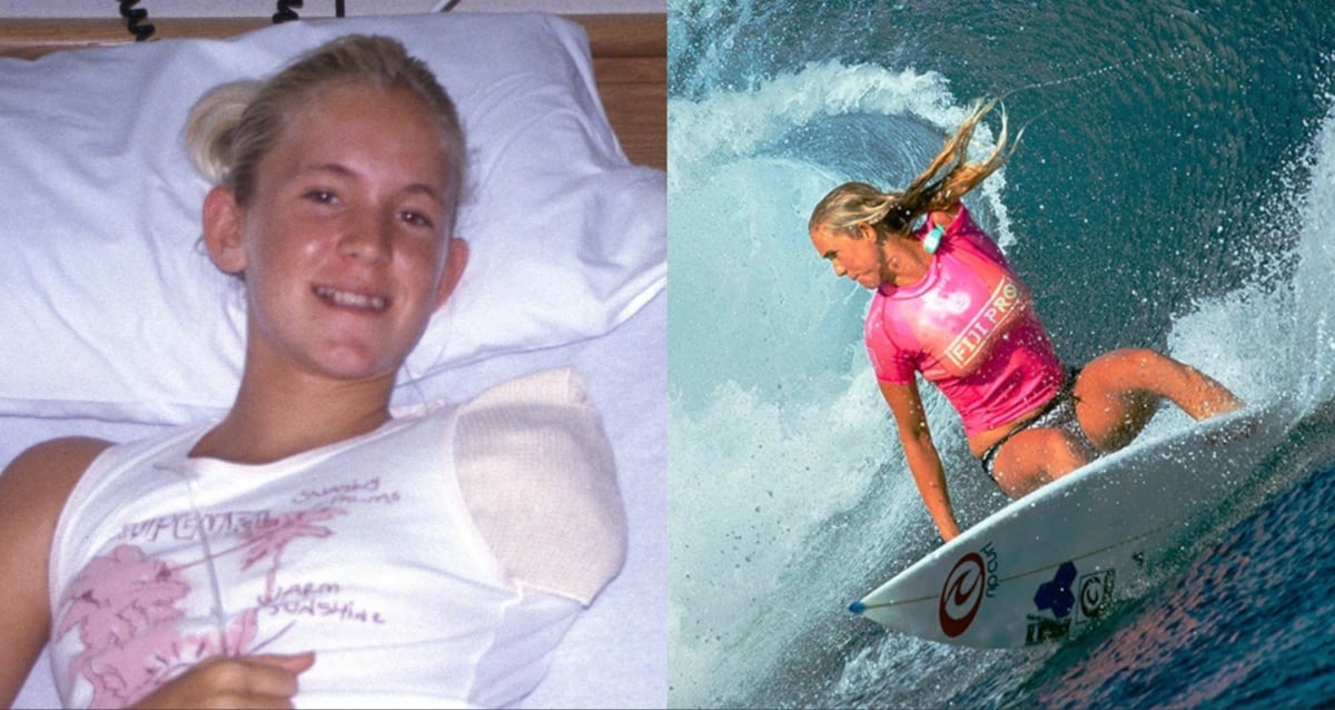 9 Of The Worst Shark Attacks In Recorded History